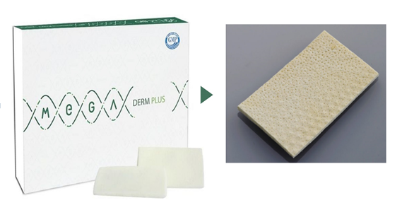 DENTAL :: SURGICAL SUPPLIES :: BONE GRAFTING AND SOFT TISSUE :: COWELL ...