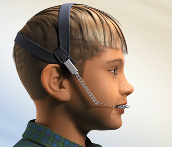 DENTAL :: ORTHODONTICS :: HEADGEAR