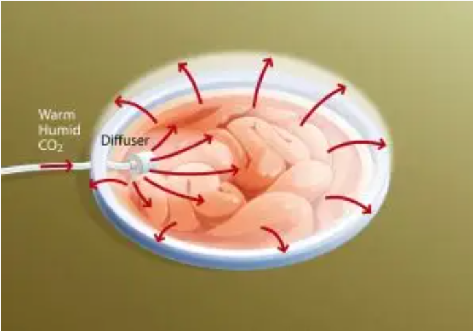 MEDICAL SUPPLIES AND DEVICES :: MEDICAL DEVICES :: CARDIOLOGY :: CO2 ...