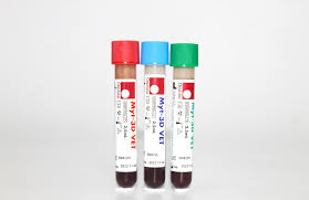 LABORATORIES :: LABORATORY MEDICINE :: HEMATOLOGY ANALYZER :: CBC ...